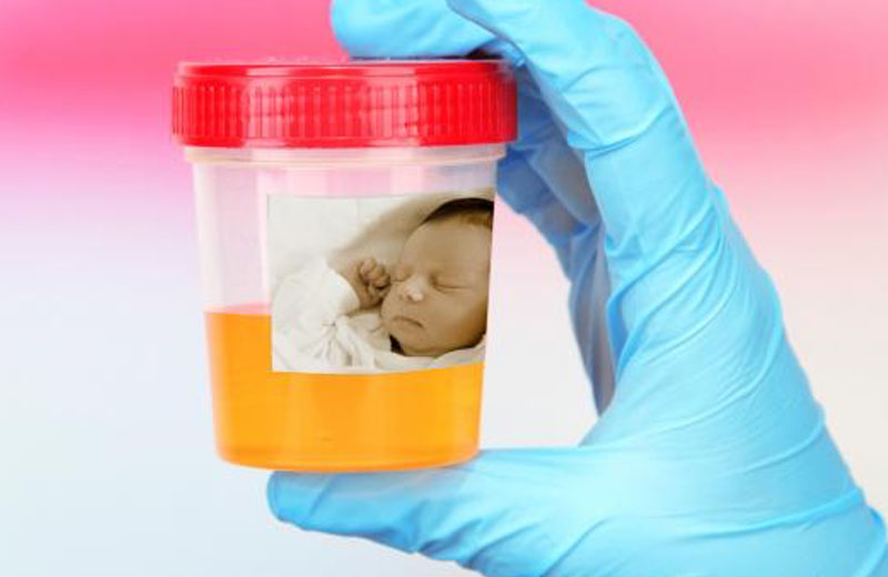 Urina de bebê pode regenerar rim adulto e salvar vidas | Só Notícia Boa