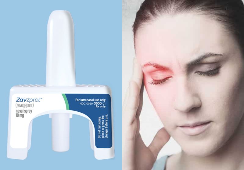 Spray nasal da Pfizer combate enxaqueca aguda 15 minutos após aplicação ...